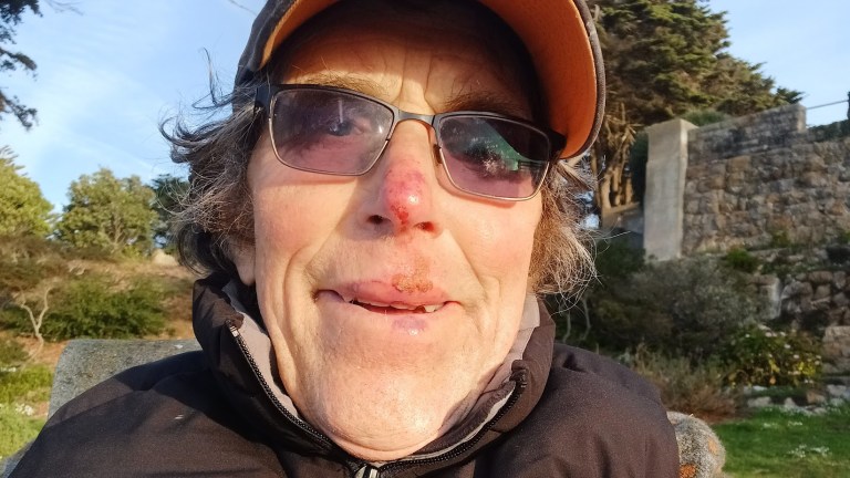 Tripped up at Trader Joe’s. A dangerous fall to the rocky street – Lee ...